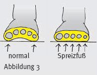 Fuss & Sprunggelenk | Orthozentrum Cham, Zug - Schweiz - Orthopädische ...