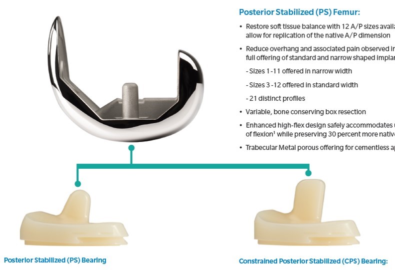 Knieprothese - das künstliche Kniegelenk | Hüfte & Knie | Orthozentrum ...